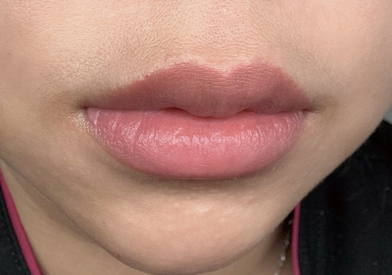The 2026 Medical-Aesthetic Guide To Dark Lip Correction - Lash Pilot ...